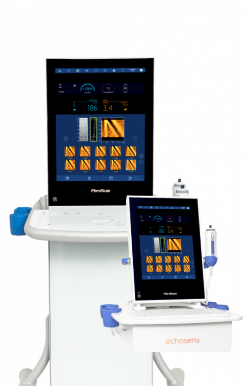 Fibroscan Liver Medical Equipment | Global Medicare