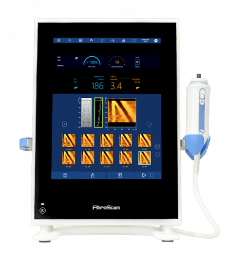 Fibroscan Liver Medical Equipment | Global Medicare
